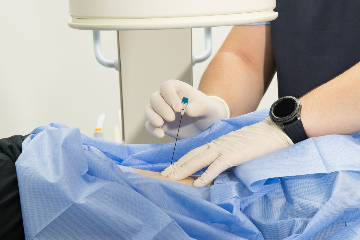 Procedures - Pain Institute of Georgia